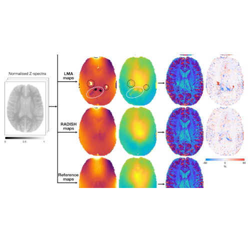 Recent Publication: Improved B0 and B1 Mapping in CEST MRI