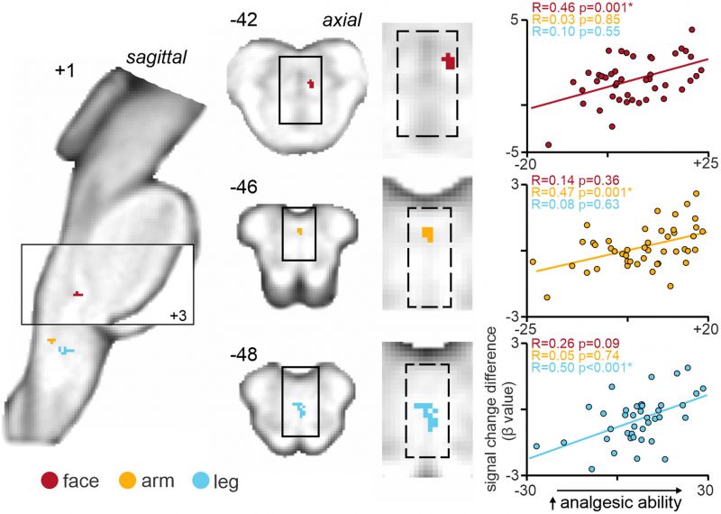 Mapping Brainstem Analgesic Circuits with 7T fMRI