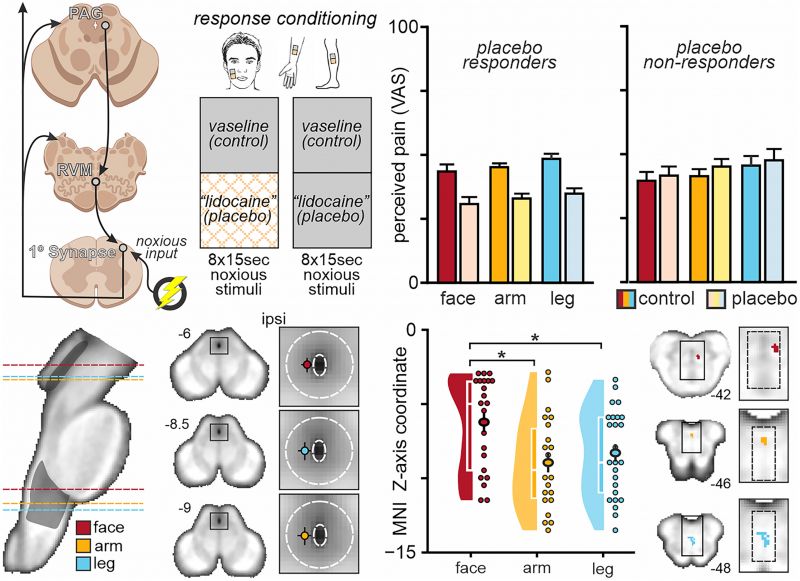 Mapping Brainstem Analgesic Circuits with 7T fMRI